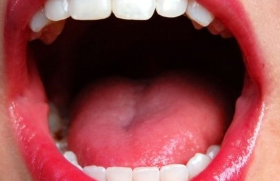 Come curare le afte | DeAbyDay